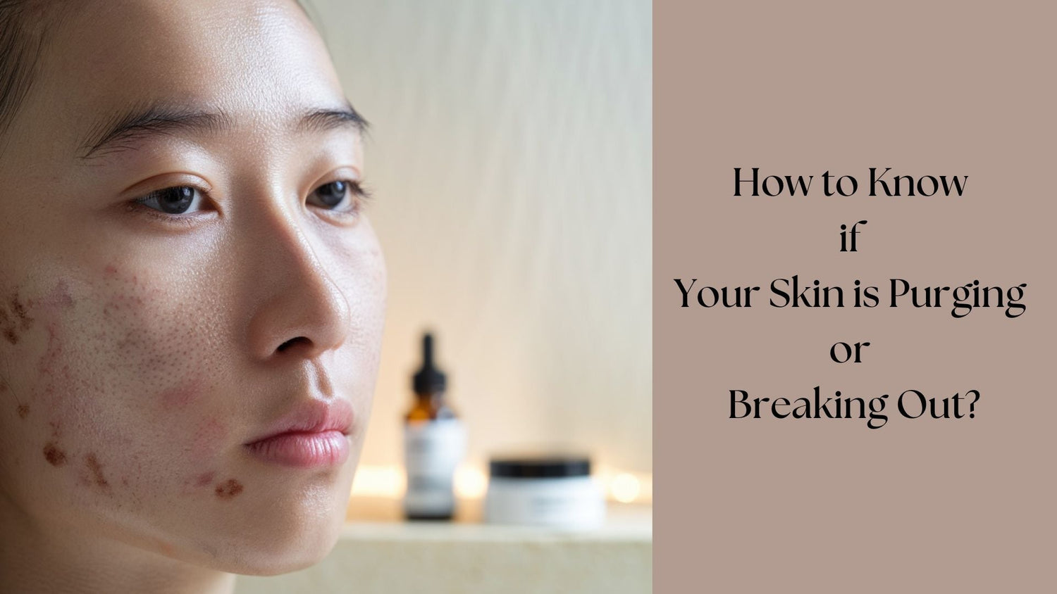 How to Know if Your Skin is Purging or Breaking Out?