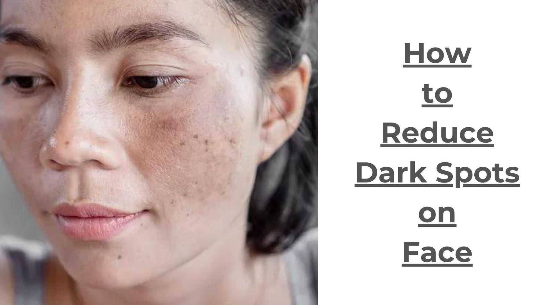 How to Reduce, Remove or Prevent Dark Spots on Face