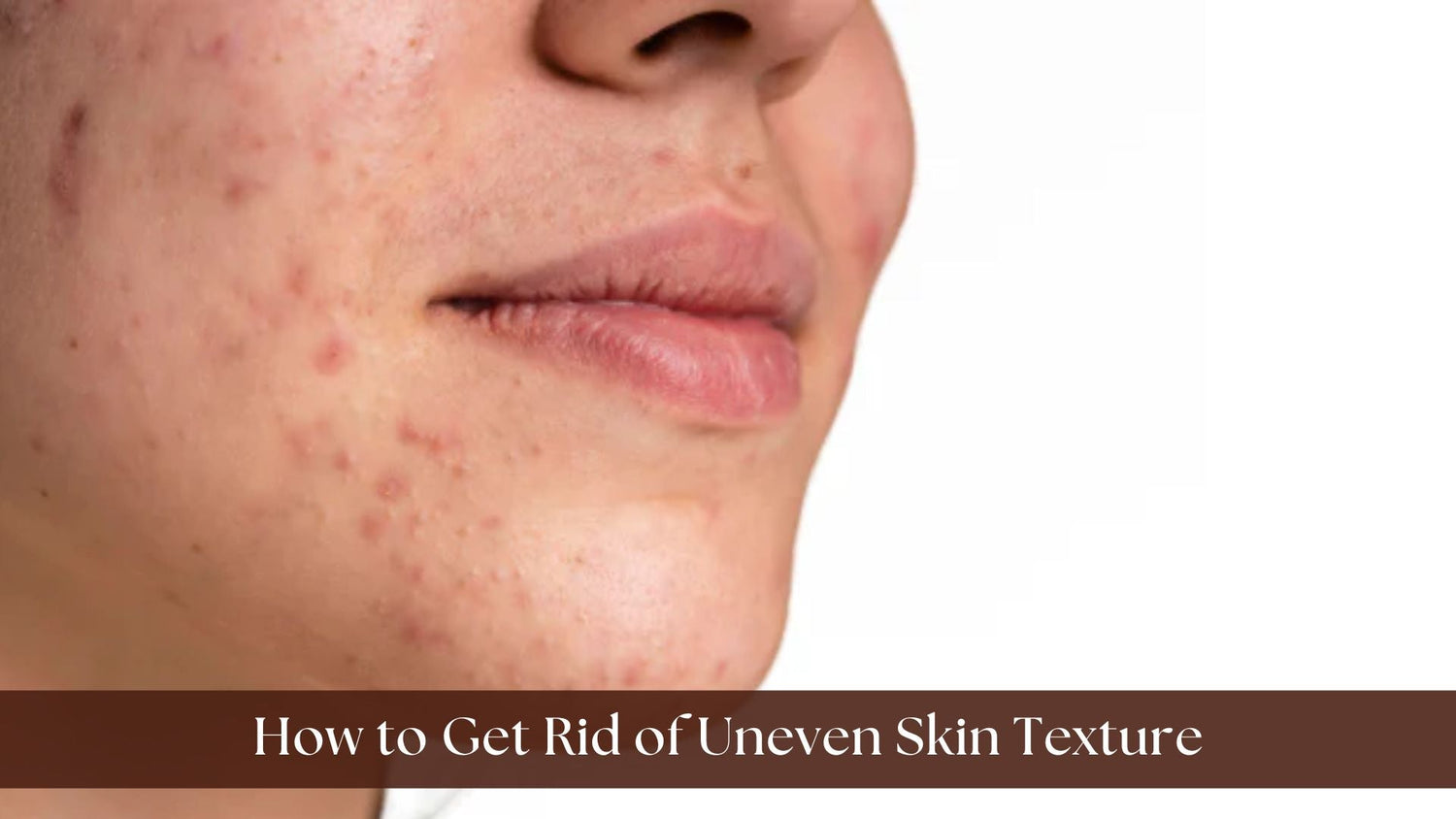 How to Smoothen and Get Rid of Uneven Skin Texture